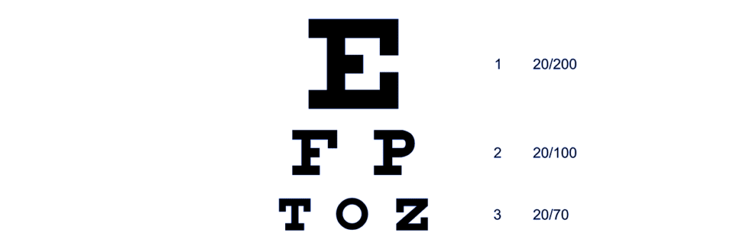 Exame de vista: Saiba como é e quando você precisa fazer