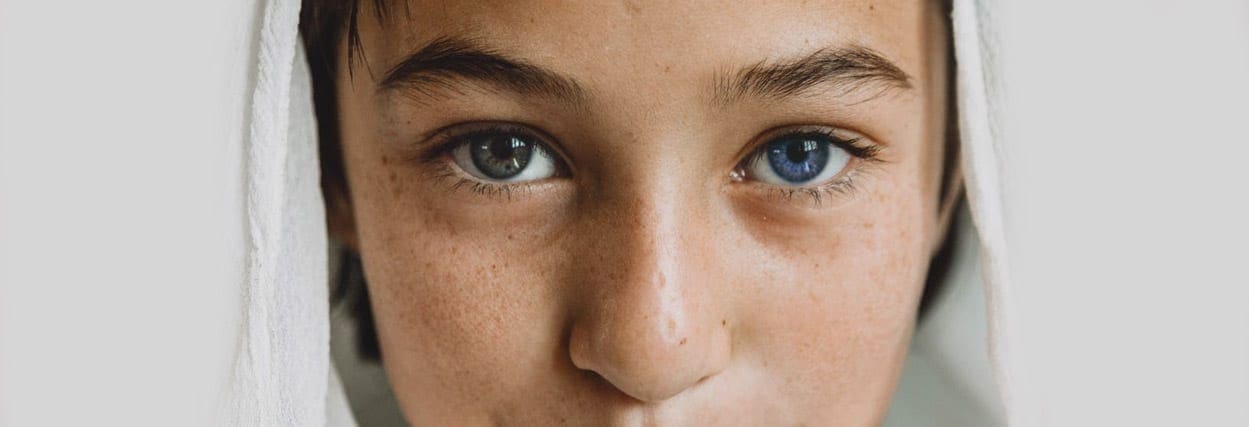 Heterocromia: um olho de cada cor | Lenscope