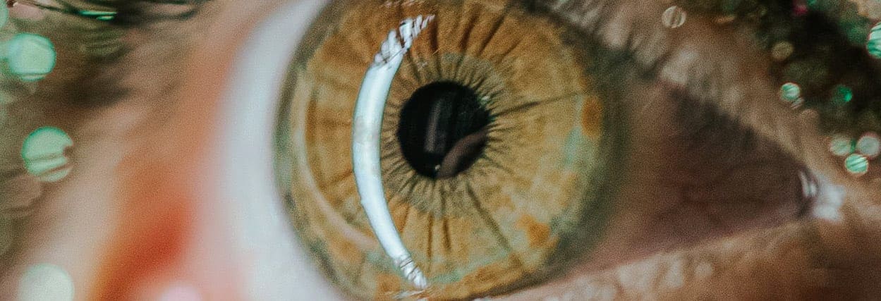 Íris do olho: função e principais anomalias | Lenscope