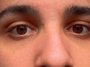 Olho cor de mel (âmbar): tudo que você precisa saber | Lenscope